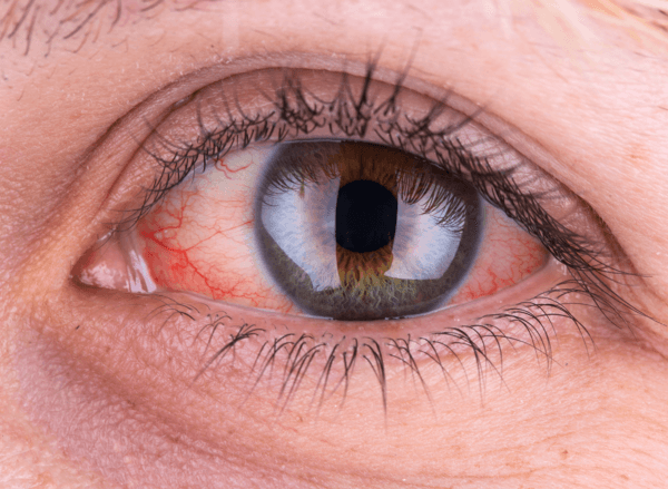 Home | Mackey Opticians